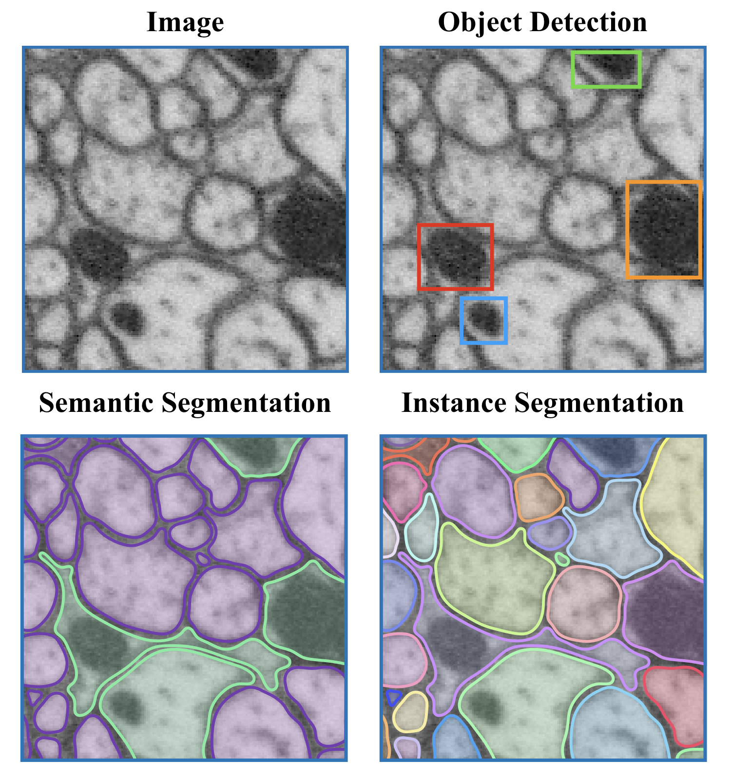 Neuron reconstruction is an instance segmentation problem because every pixel ofevery neuron ...